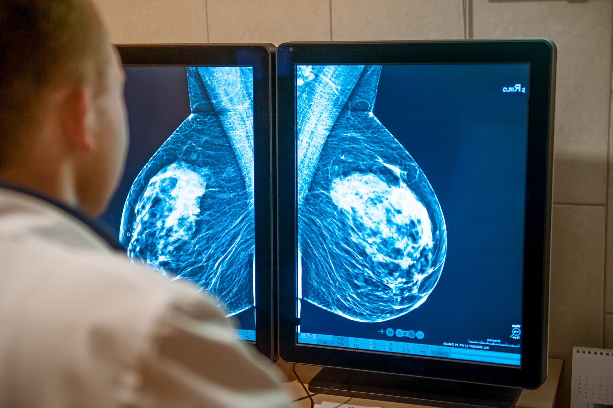 Mammograms for Small Breasts | Little Silver HerSpace